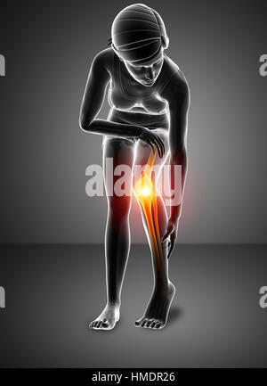 3d Illustration of Women Knee pain Stock Photo - Alamy