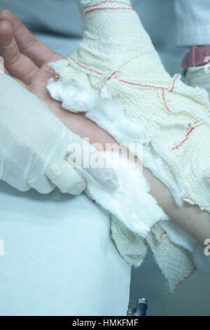 male nurse removing a plaster cast using a plaster cutting saw in A&E ...