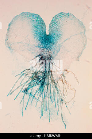 fern plant under the microscope Stock Photo: 227729836 - Alamy