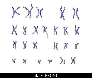 Philadelphia chromosome.Computer illustration of male or female ...