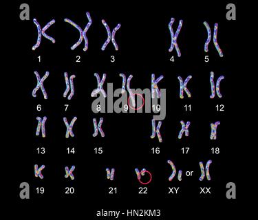 Philadelphia chromosome.Computer illustration of male or female ...