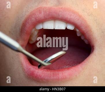 Close up of an extensive dental examination Stock Photo - Alamy