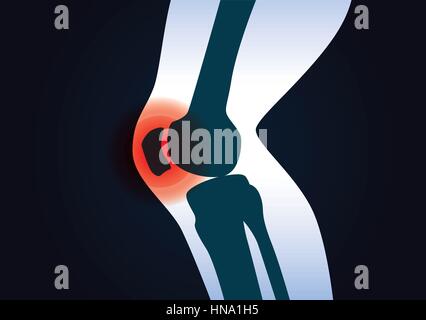 Human Knee Anatomy diagram Stock Vector Image & Art - Alamy