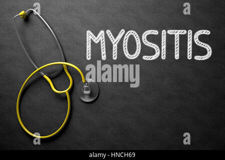 Myalgia Concept on Chalkboard. 3D Illustration Stock Photo - Alamy