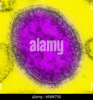 Measles virus. Transmission electron micrograph (negative stain) of a ...