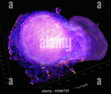 Transparent tumor tomography visualising tumor microenvironment ...