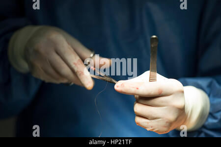 surgeon's hands holding a needle and thread and a needle holder Stock ...