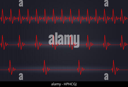 medicine illustration of heart pulsating fast normal and slow Stock ...