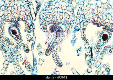 Antheridia on Moss Stock Photo - Alamy