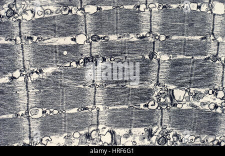 A transmission electron micrograph (TEM) of skeletal muscle in cross Stock Photo: 9150660 - Alamy
