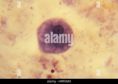 Entamoeba histolytica (LM Stock Photo - Alamy