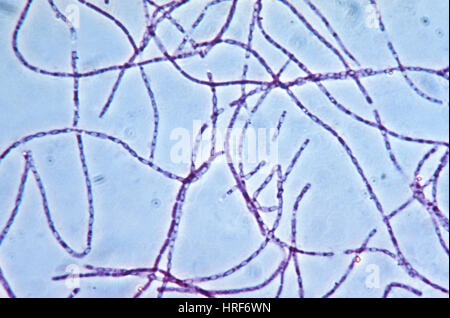 Anthrax bacteria. Light micrograph (LM) of the rod-shaped bacteria ...