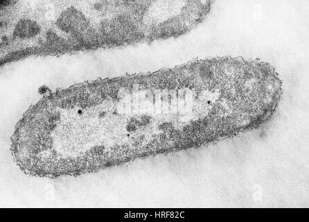E. coli Infected with T2 Bacteriophage, TEM Stock Photo - Alamy