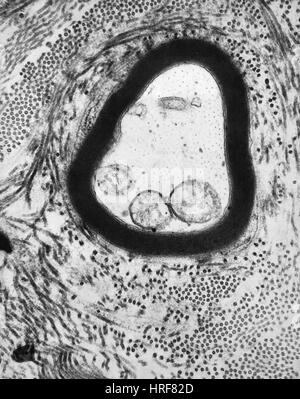 transmission electron micrograph of myelin sheath Stock Photo: 76787465 ...