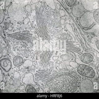 Transmission electron micrograph (TEM) of the Golgi apparatus of a cell ...