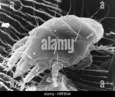 Acarine Mite, SEM Stock Photo - Alamy