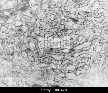 Endoplasmic reticulum, TEM Stock Photo - Alamy