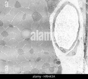 Cat Soleus Muscle, TEM Stock Photo - Alamy