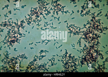 Salmonella Typhi. Light micrograph of the Gram- negative, rod-shaped ...