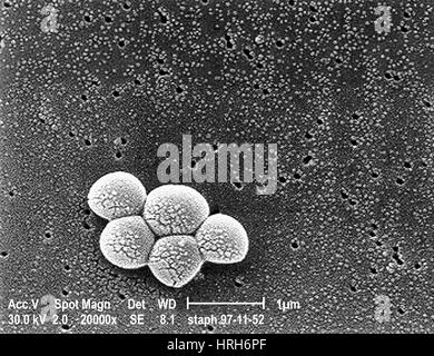 methicillin resistant staph aureus (MRSA) skin infection in a 26 year ...