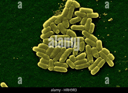 Escherichia coli O157:H7 Bacteria, SEM Stock Photo - Alamy