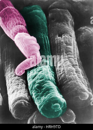 SEM of rods and cones of the retina Stock Photo - Alamy