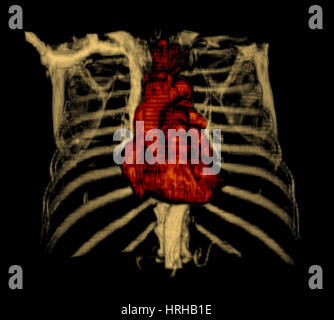 3D CT Reconstruction of Heart Stock Photo - Alamy