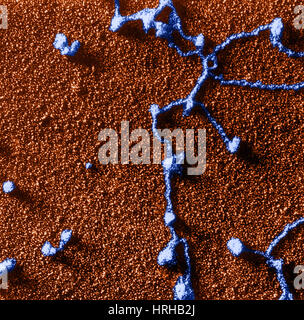 TEM of RNA attached to DNA Stock Photo - Alamy