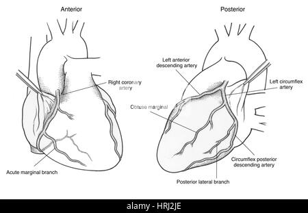 Obtuse Marginal Coronary Artery Anatomy
