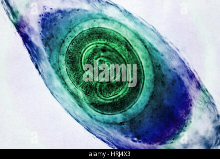 Light micrograph of muscle with encysted Trichinella spiralis (purple ...