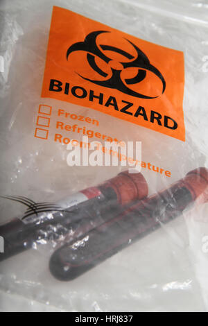 Blood Samples in a Biohazard Bag Stock Photo - Alamy