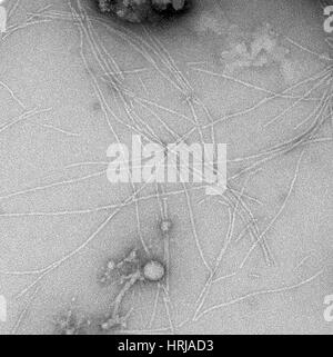 Amyloid Fibrils (TEM Stock Photo - Alamy
