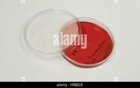 This is a xylose-lysine-deoxycholate (XLD) agar culture plate that ...