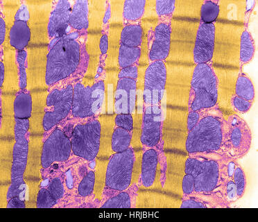 Rabbit Cardiac Muscle, TEM Stock Photo - Alamy