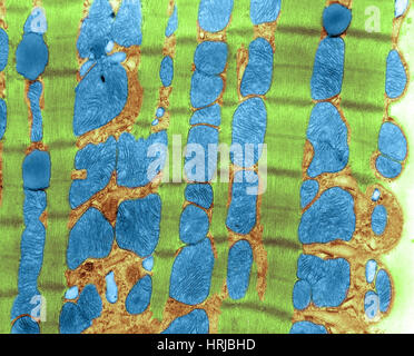 Rabbit Cardiac Muscle, TEM Stock Photo - Alamy
