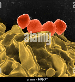 Streptococcus pyogenes Bacteria, SEM Stock Photo - Alamy