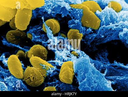 Scanning electron micrograph of Yersinia pestis, which causes bubonic ...