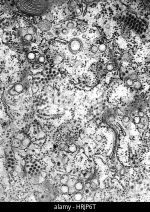 St. Louis Encephalitis Virus, TEM Stock Photo - Alamy