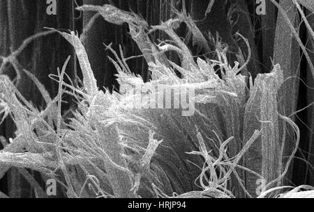 Scanning electron micrograph of chrysotile, white asbestos Stock Photo ...
