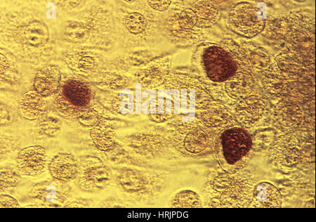 Chlamydia trachomatis Bacteria, LM Stock Photo - Alamy