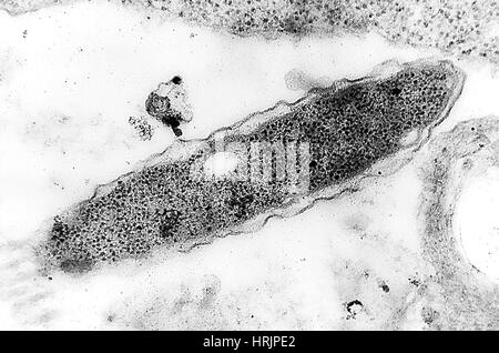Transmission electron micrograph (TEM) of Legionella pneumophila, the ...