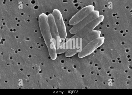 Sebaldella termitidis Bacteria Dividing, SEM Stock Photo - Alamy