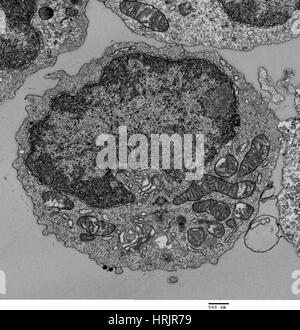 Human B Lymphocyte, TEM Stock Photo - Alamy