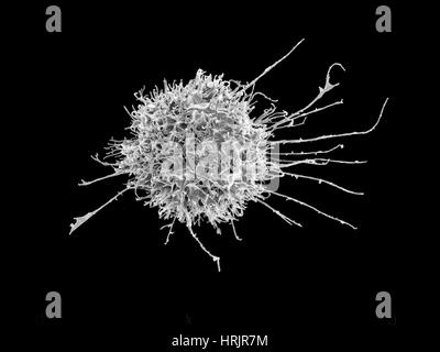 Electron Microscopy of a normal human cell, The cell membrane, nucleus ...