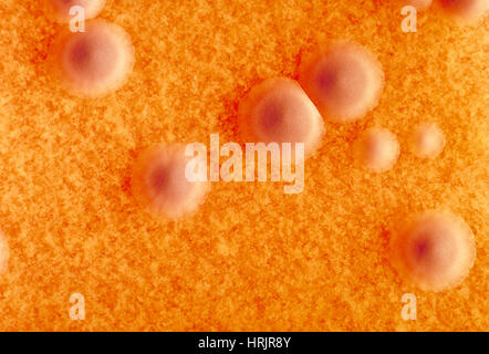 Corynebacterium diphtheriae, Colonial Growth Stock Photo - Alamy