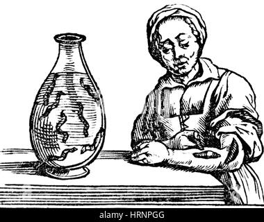 Bloodletting, Leech Method Stock Photo - Alamy