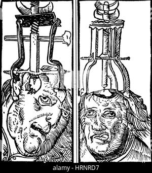 Trepanning, trephining burr hole, woodcut from "Feldtbuch der Stock ...