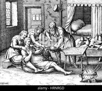 Leg amputation. Doctor sawing off a leg. Date: 1739 Stock Photo - Alamy