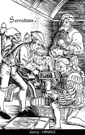 Leg amputation. Doctor sawing off a leg. Date: 1739 Stock Photo - Alamy