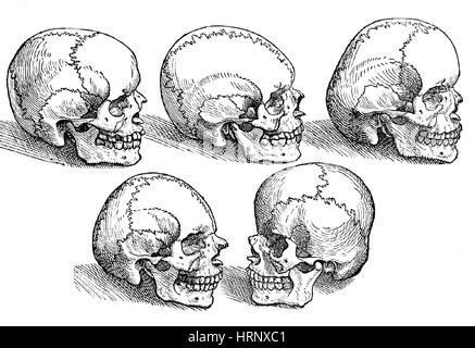 Normal and Abnormal Skulls, 16th Century Stock Photo - Alamy